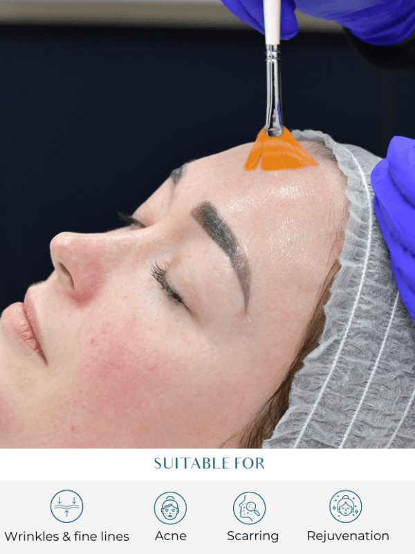 Dermalux Tri-Wave MD LED Phototherapy Treatment | Perfect Skin Solutions