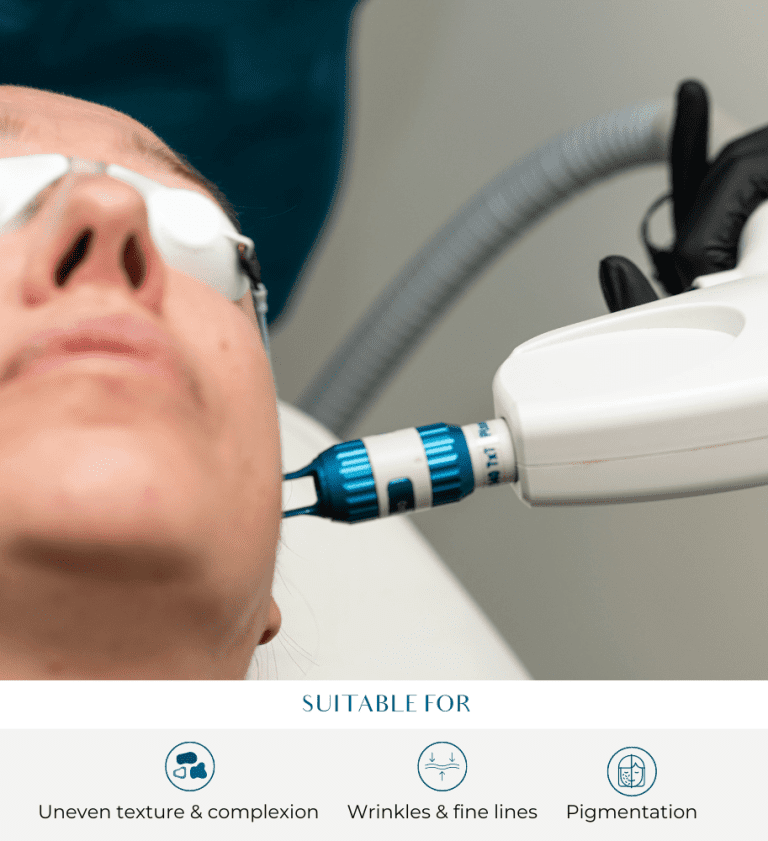 iPixel Skin Resurfacing | Before & After | Perfect Skin Solutions