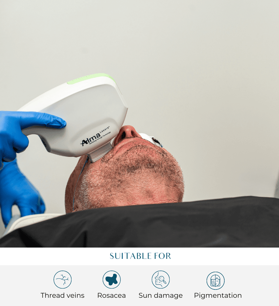 IPL Intense Pulsed Light | Before & After | Perfect Skin Solutions