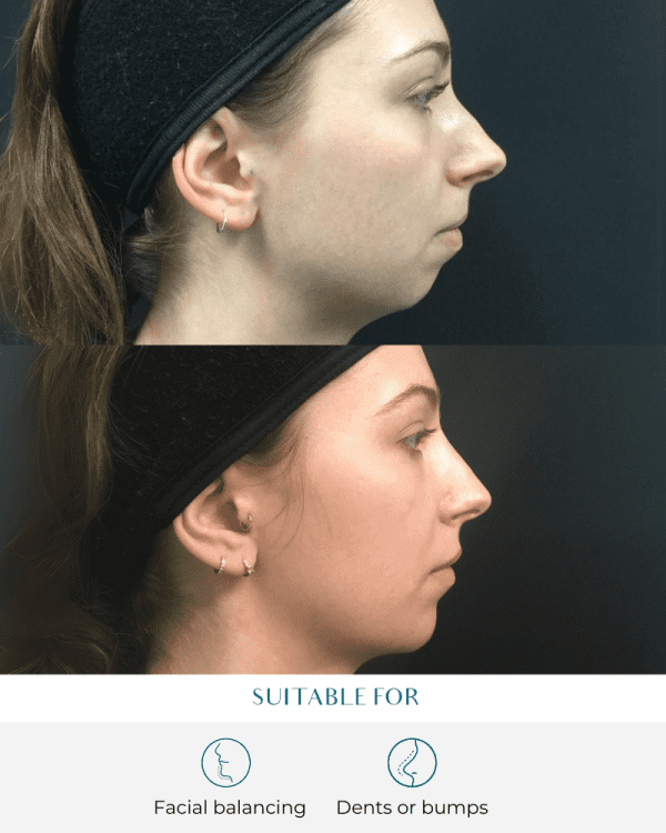 Pore-Clogging Ingredients Checker - Comedogenic Checker