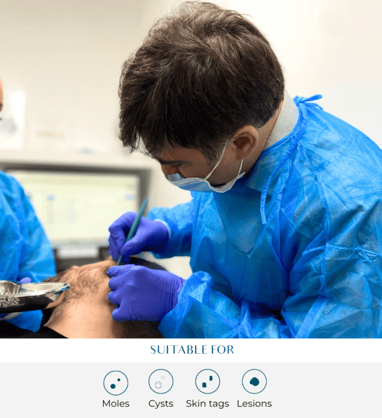 Essential Guide to Private Cyst Removal: Options and Considerations