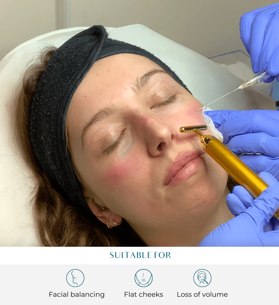 Cheek Fillers - Before & After - Perfect Skin Solutions