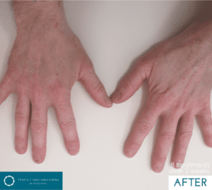 Dermalux Tri-Wave MD LED Phototherapy Treatment | Perfect Skin Solutions