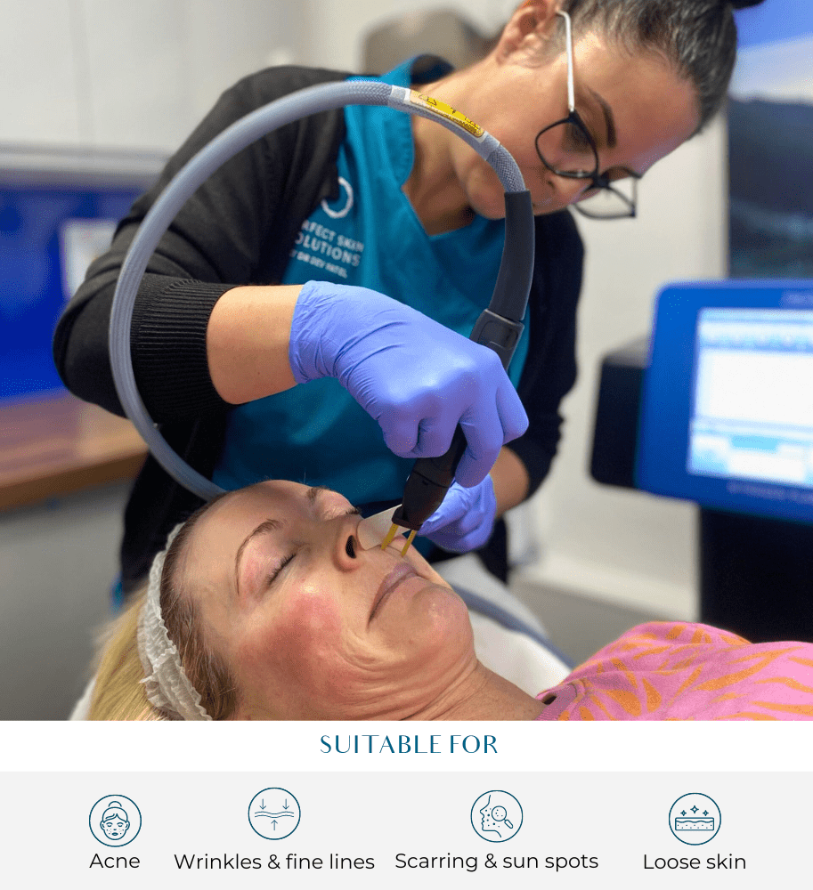 NeoGen PSR Treatment | NeoGen Start from £300 - Portsmouth, UK