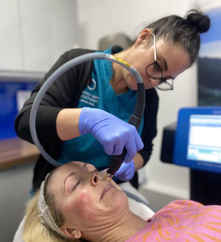 NeoGen PSR Treatments at Perfect Skin Solutions