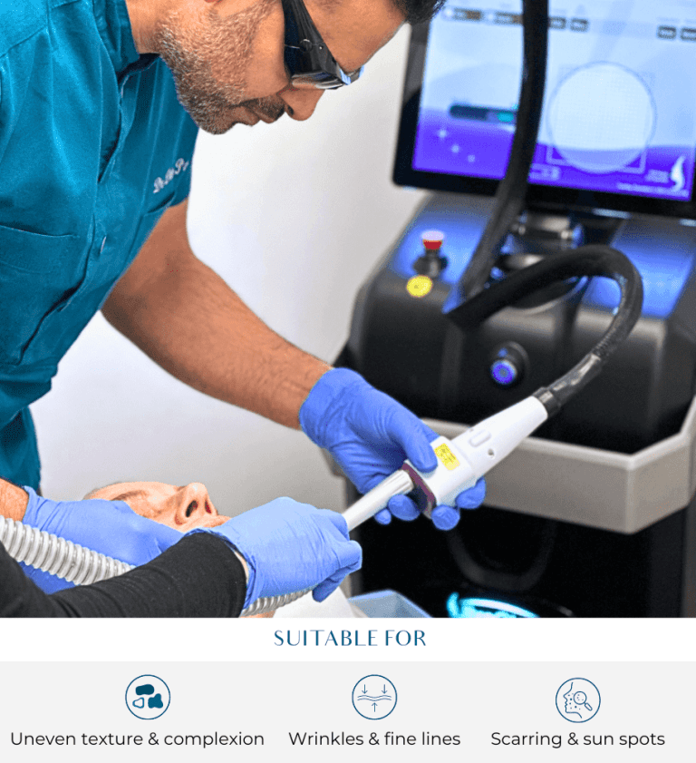 UltraClear From £450: Cold Fibre Laser Technology at Perfect Skin Solutions