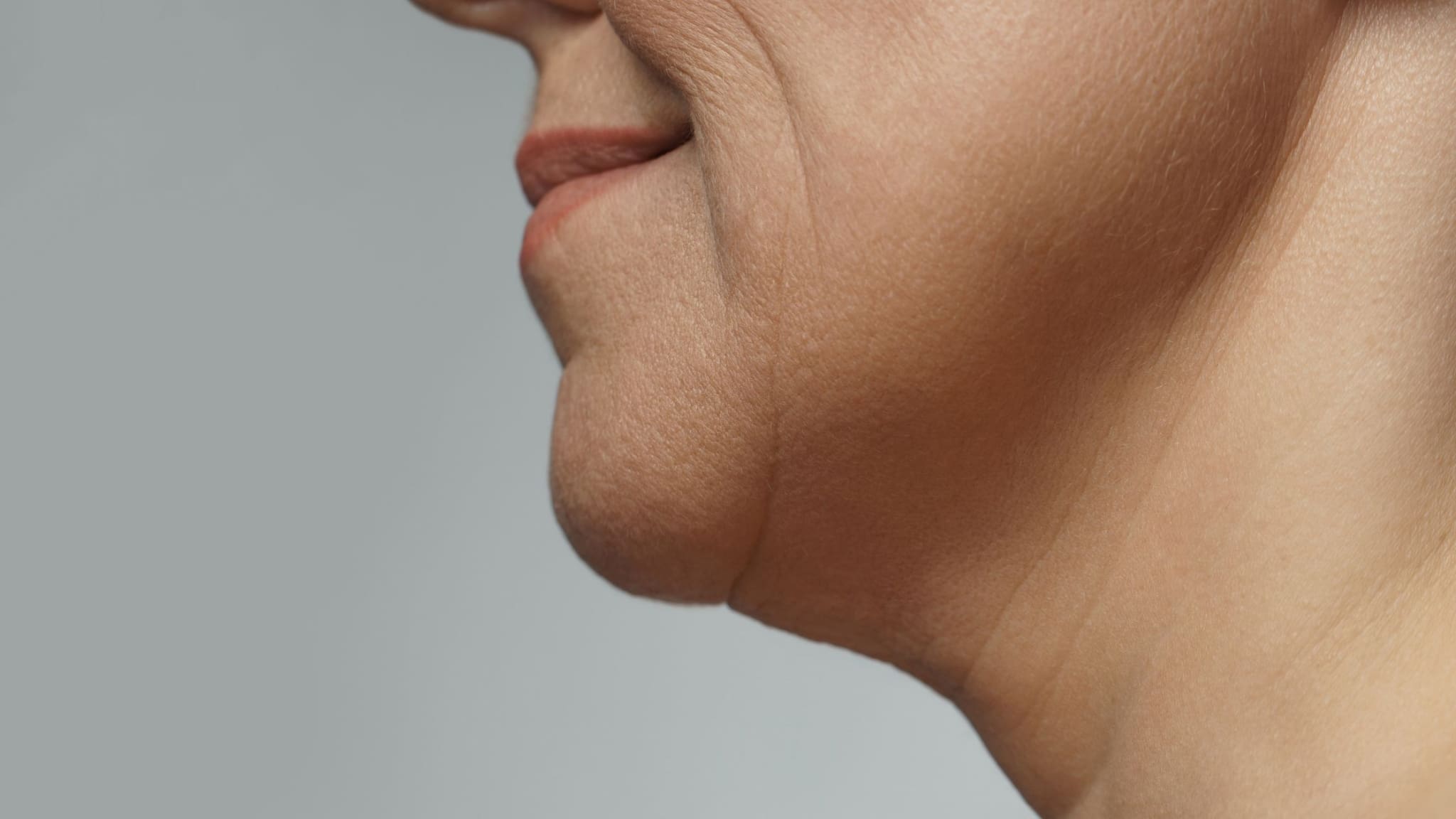 Understanding Jowls: What They Are and How to Manage Them | 24-7.is